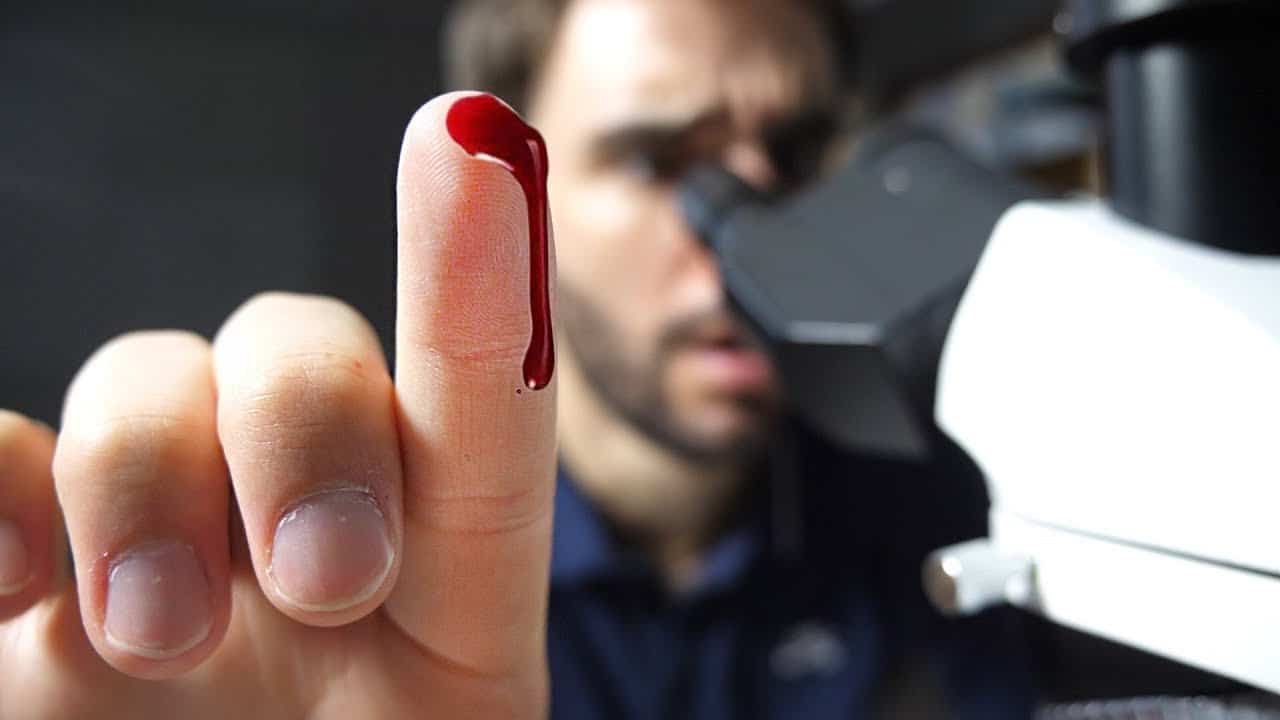 Docteur Nozman montre le contenu du sang au microscope