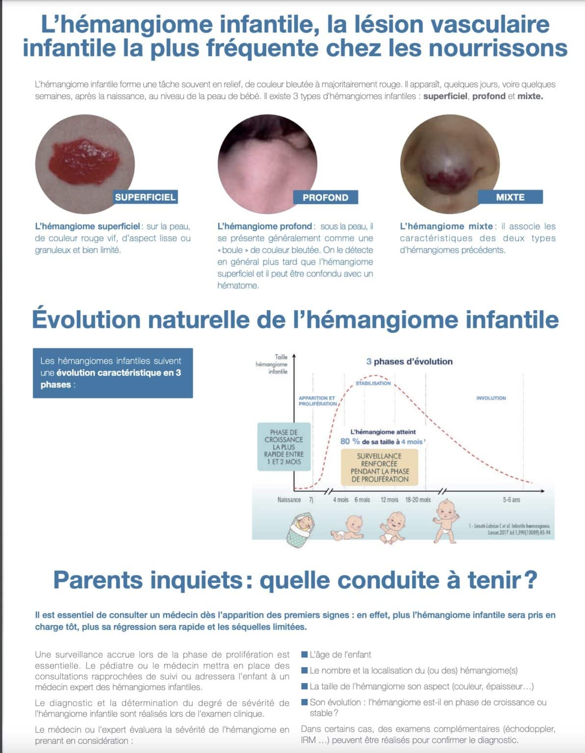 L'hémangiome infantile n’est pas une tache de naissance. Il doit être ...